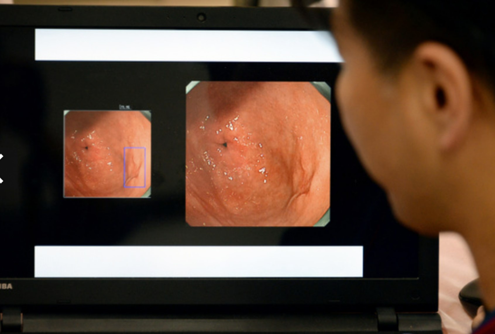 第10回 講演会のお知らせ | DMIL（Digital Medical Innovation Lab.）